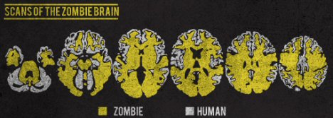 The neurology of the undead – Mind Hacks
