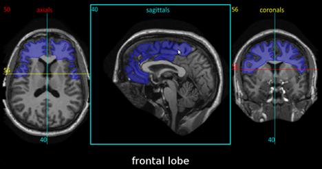 Mri Anatomy Brain MRI Scans Reveal Detailed Internal Structures | Open