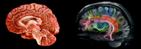 The cutting edge of brain science technologies – Mind Hacks